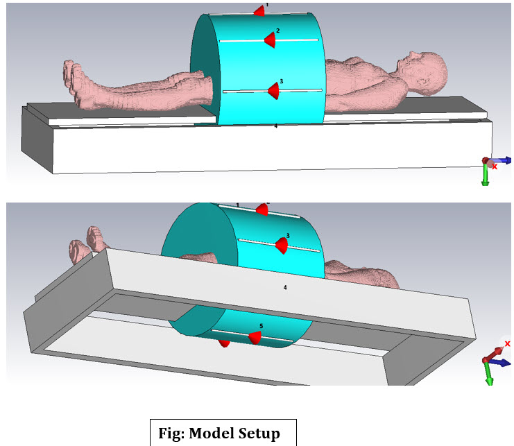 Simulating Hyperthermia Treatment: How CST Helps Design Safer RF Cancer ...